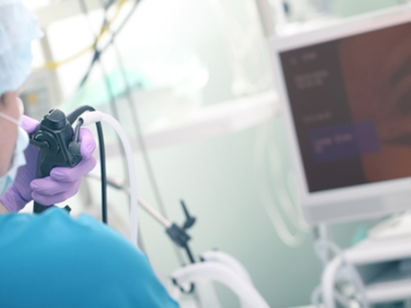 Endoscopia Digestiva Alta – Clínica Concon