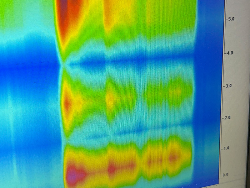 PHmetria Esofágica 24Horas - Clínica Concon